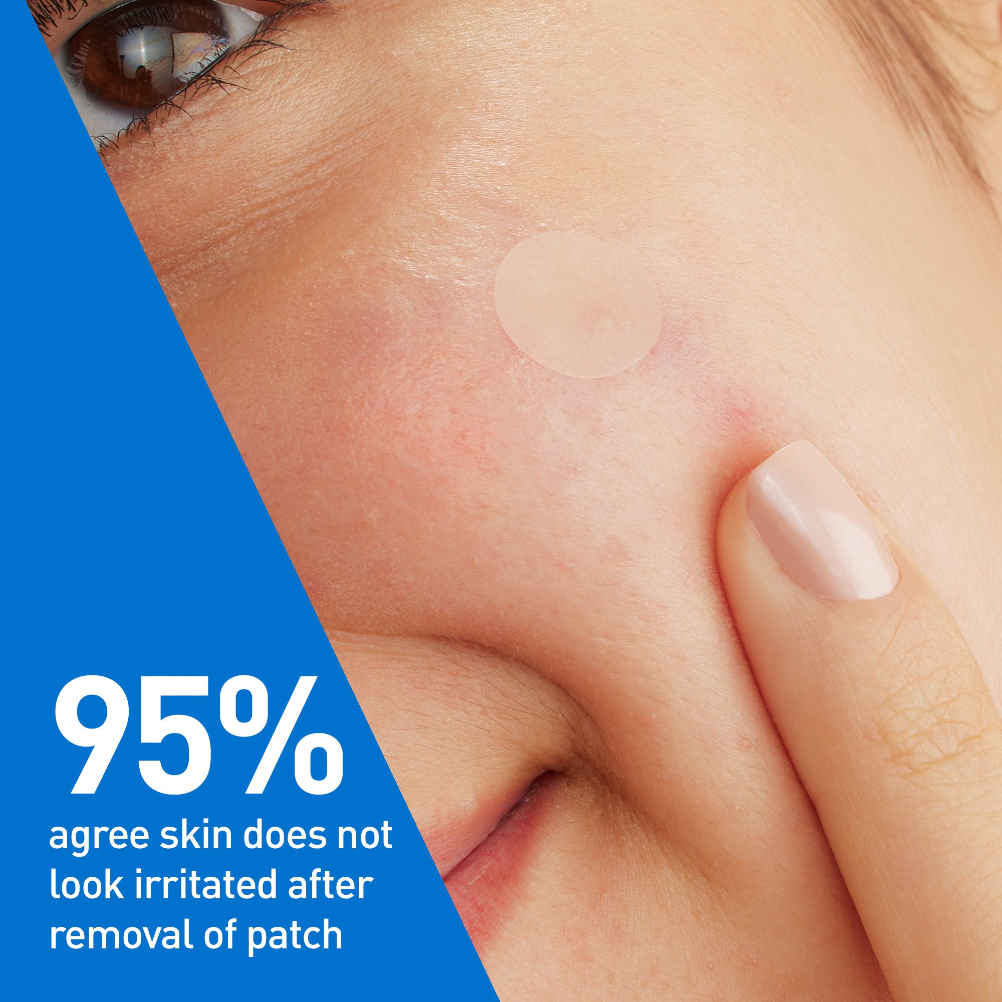 Anti-Spot Barrier Patches - Visible Results in 3HRS - CeraVe