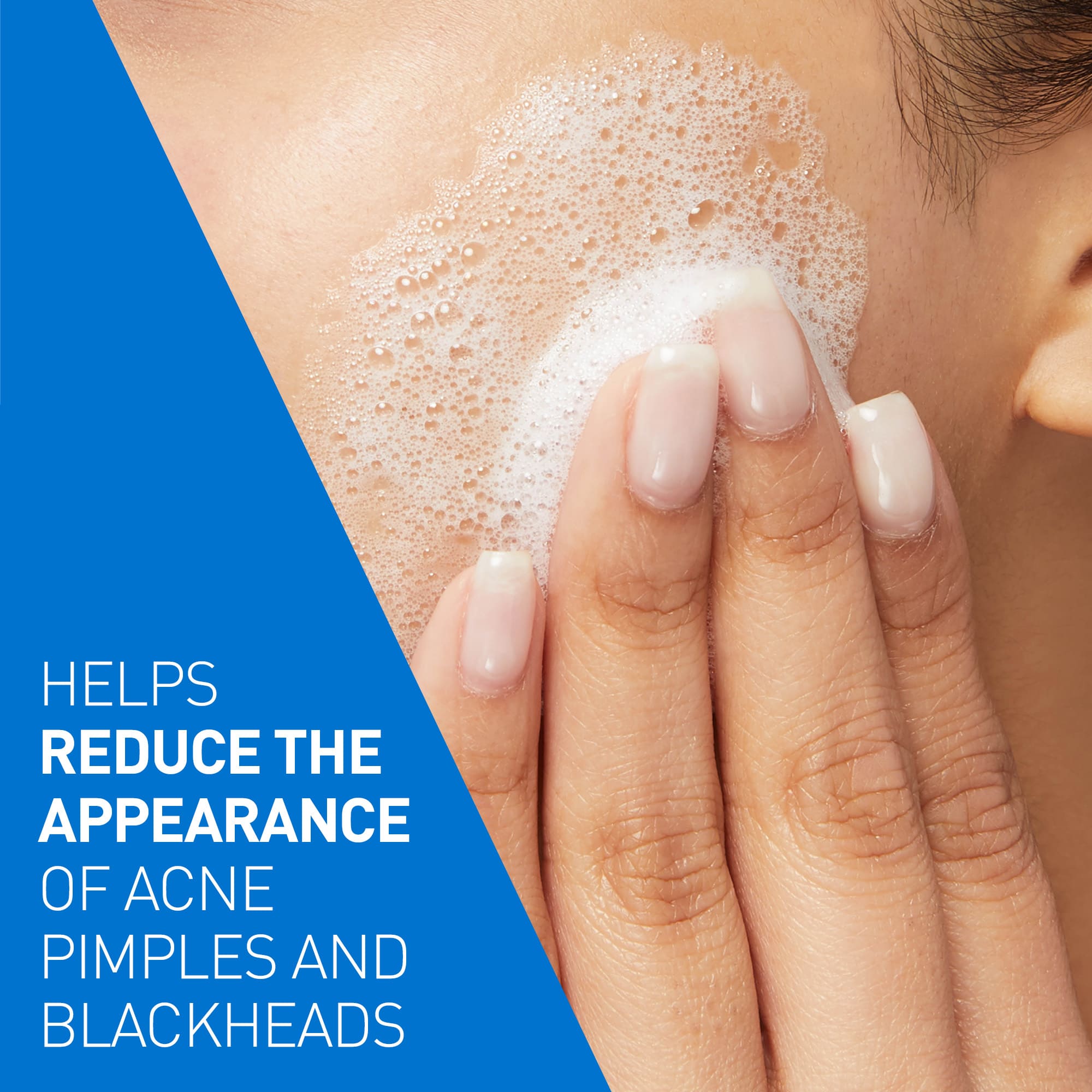 Daily Acne Control Cleanser with 2% Salicylic Acid - CeraVe