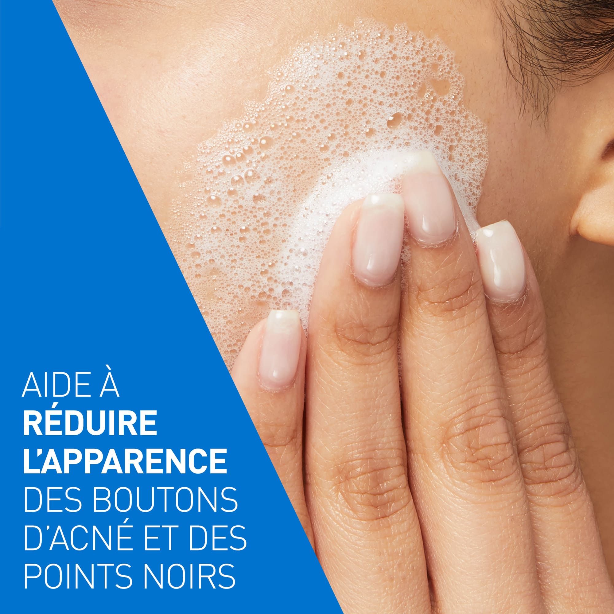 Nettoyant Anti-Acné Concentré 2% Acide Salicylique - CeraVe
